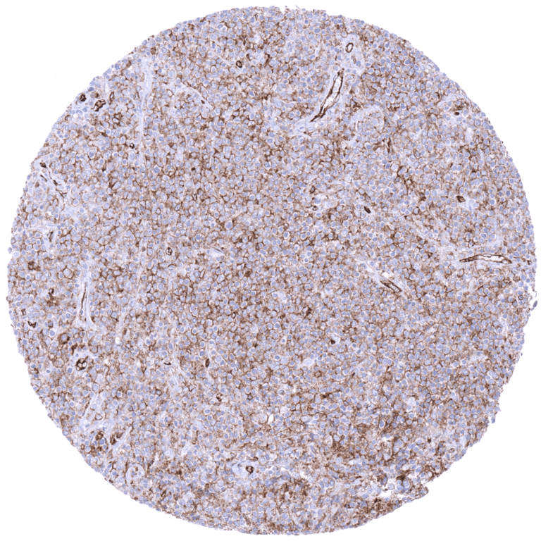 Cancer Tissue Gallery CD31 - MS Validated Antibodies