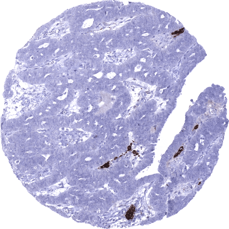 Cancer Tissue Gallery Inhibin Alpha - MS Validated Antibodies