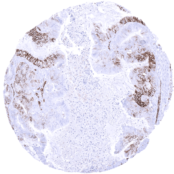 Cancer Tissue Gallery CD31 - MS Validated Antibodies