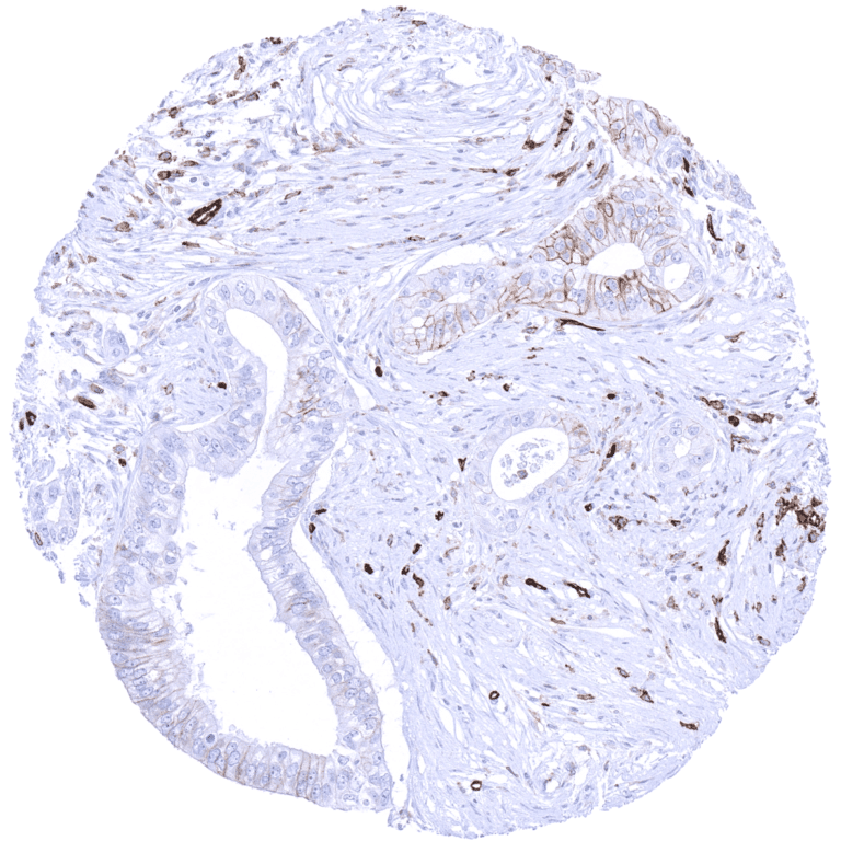 Cancer Tissue Gallery CD31 - MS Validated Antibodies