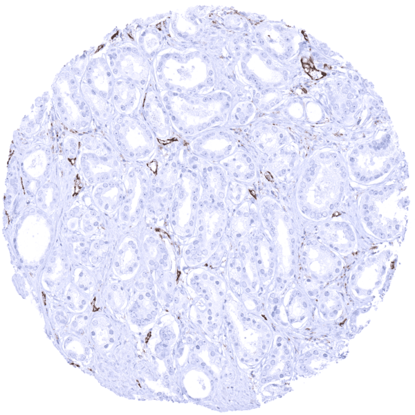 Cancer Tissue Gallery CD31 - MS Validated Antibodies