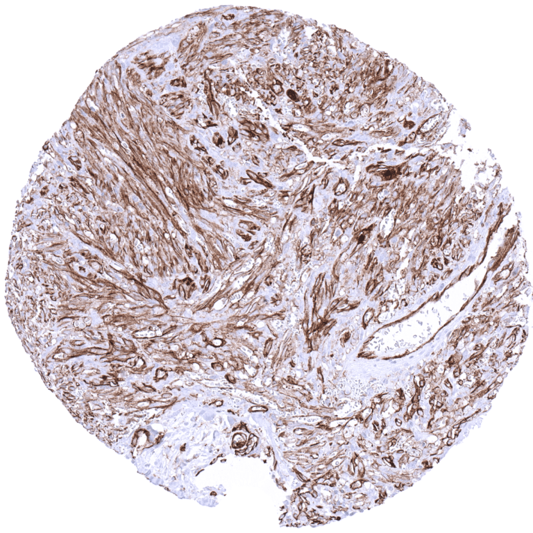 Cancer Tissue Gallery CD31 - MS Validated Antibodies