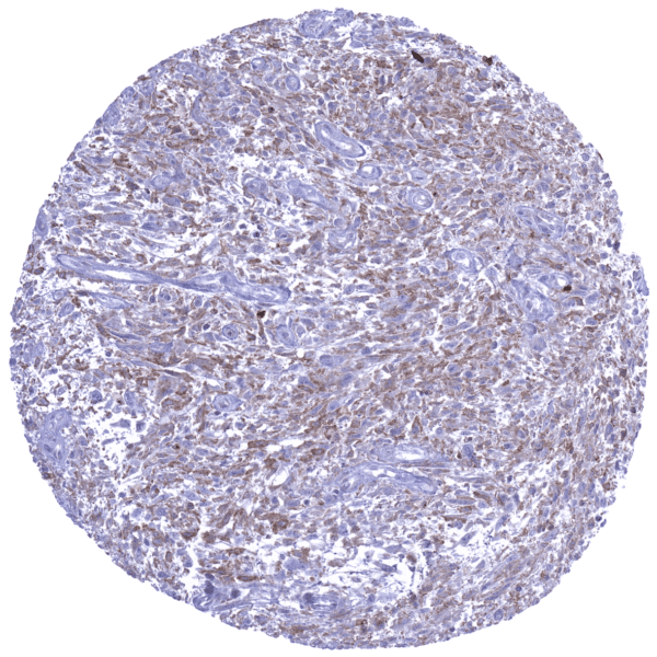 Cancer Tissue Gallery TIM-3 - MS Validated Antibodies