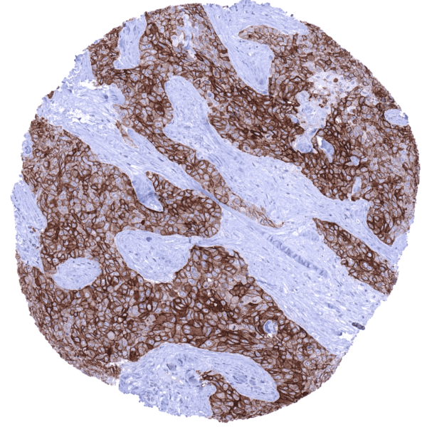 Cancer Tissue Gallery TACSTD2 / Trop-2 - MS Validated Antibodies