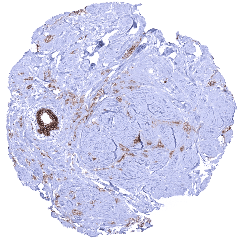 Cancer Tissue Gallery TACSTD2 / Trop-2 - MS Validated Antibodies
