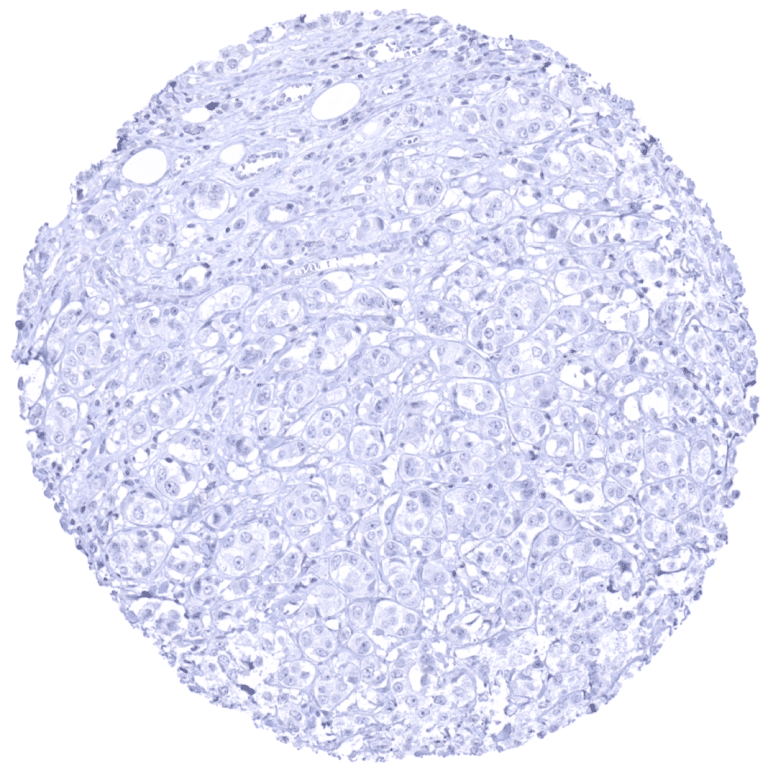 Cancer Tissue Gallery PGP9.5 / UCHL1 - MS Validated Antibodies