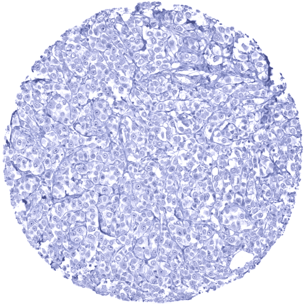 Cancer Tissue Gallery SATB2 - MS Validated Antibodies