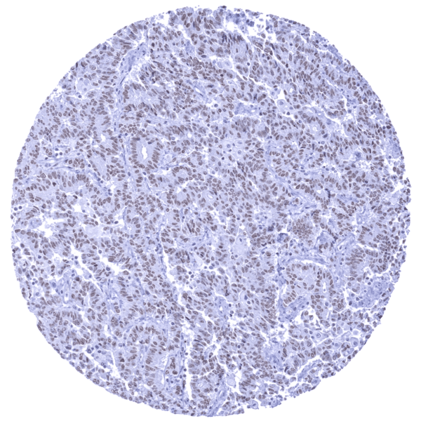 Cancer Tissue Gallery SATB2 - MS Validated Antibodies