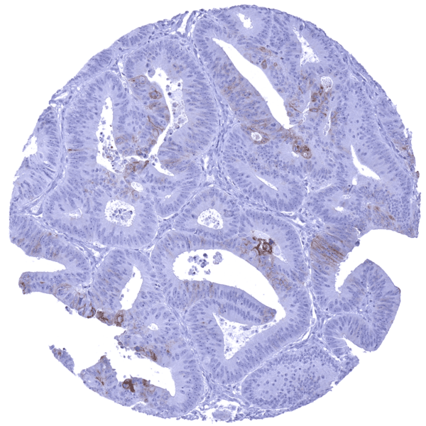 Cancer Tissue Gallery TACSTD2 / Trop-2 - MS Validated Antibodies