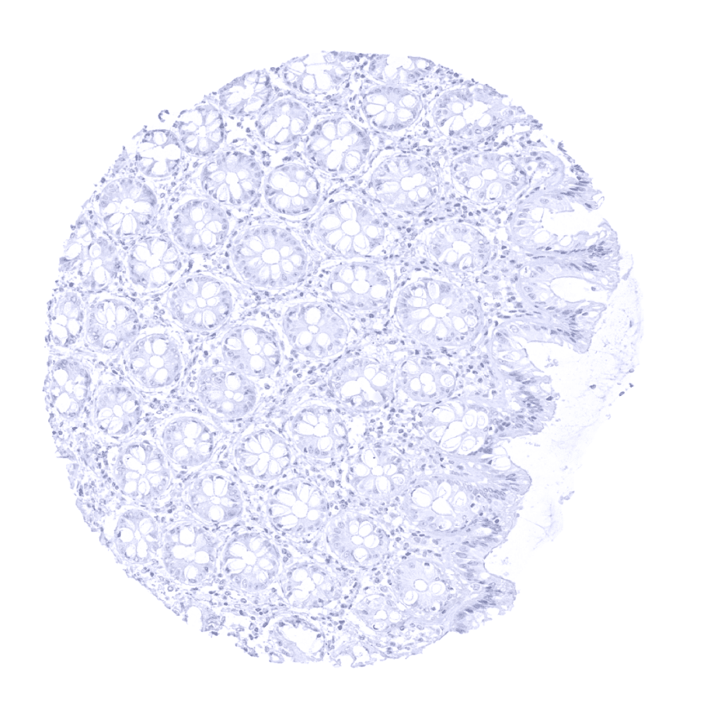 PMEL 17 / gp100 / Melanosome (MSVA-617R) - MS Validated Antibodies