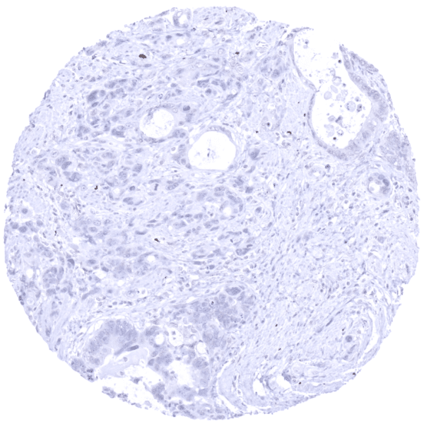 Cancer Tissue Gallery PGP9.5 / UCHL1 - MS Validated Antibodies