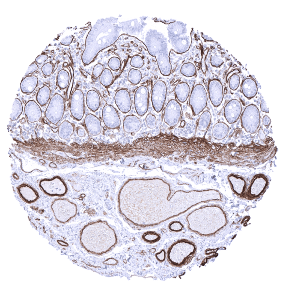 Collagen IV (MSVA-704R) - MS Validated Antibodies