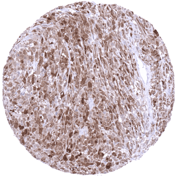 Cancer Tissue Gallery PGP9.5 / UCHL1 - MS Validated Antibodies