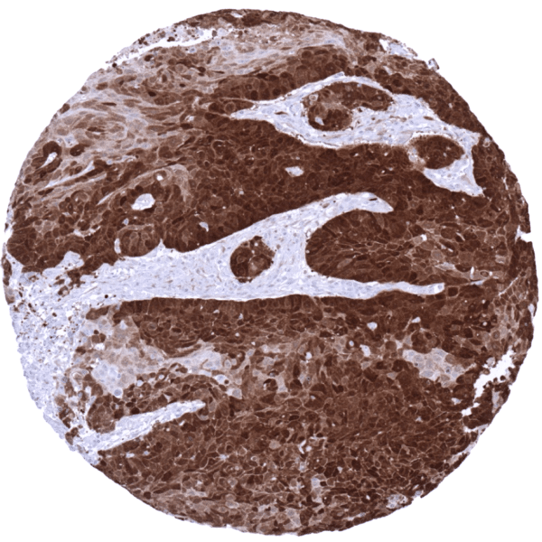 Cancer Tissue Gallery PGP9.5 / UCHL1 - MS Validated Antibodies