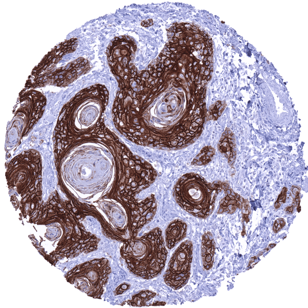 TACSTD2 / Trop-2 (MSVA-733R) - MS Validated Antibodies