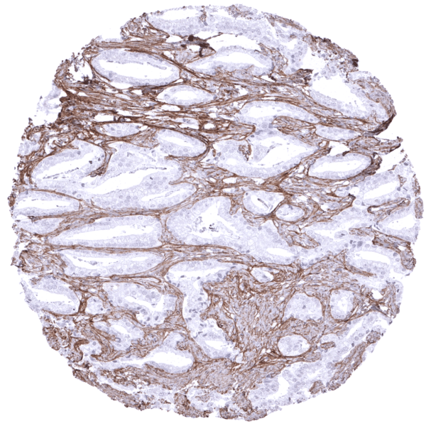 Collagen IV (MSVA-704R) - MS Validated Antibodies