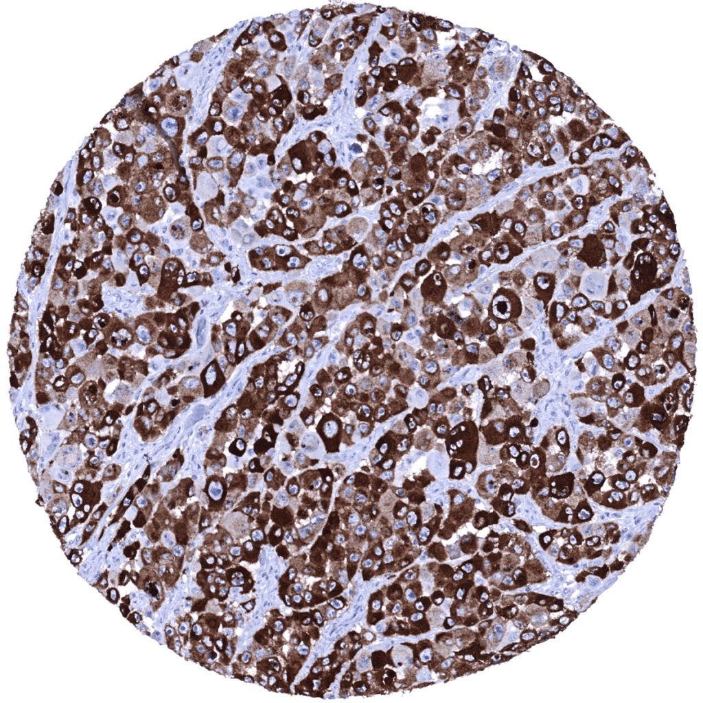 PMEL 17 / gp100 / Melanosome (MSVA-617R) - MS Validated Antibodies