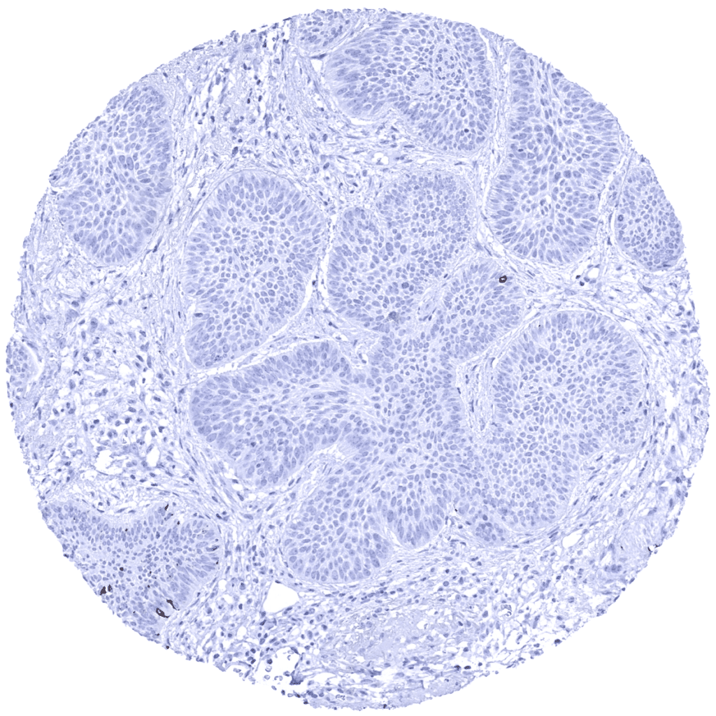 PMEL 17 / gp100 / Melanosome (MSVA-617R) - MS Validated Antibodies