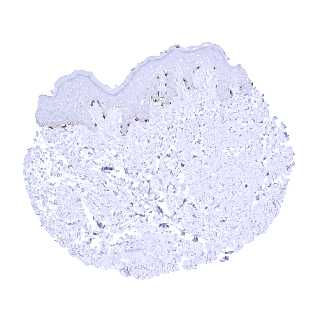 PMEL 17 / gp100 / Melanosome (MSVA-617R) - MS Validated Antibodies