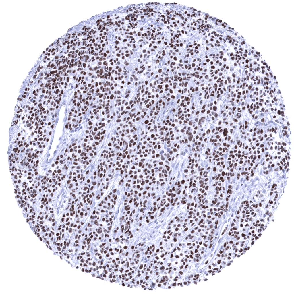 MyoD1 (MSVA-801R) - MS Validated Antibodies