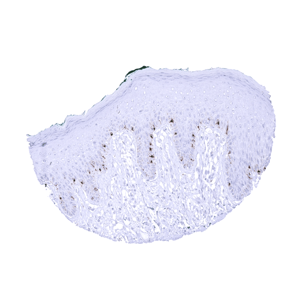 PMEL 17 / gp100 / Melanosome (MSVA-617R) - MS Validated Antibodies