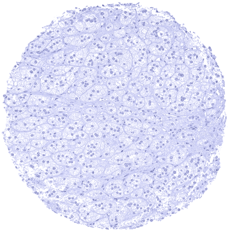 Cancer Tissue Gallery Calbindin 1 - MS Validated Antibodies
