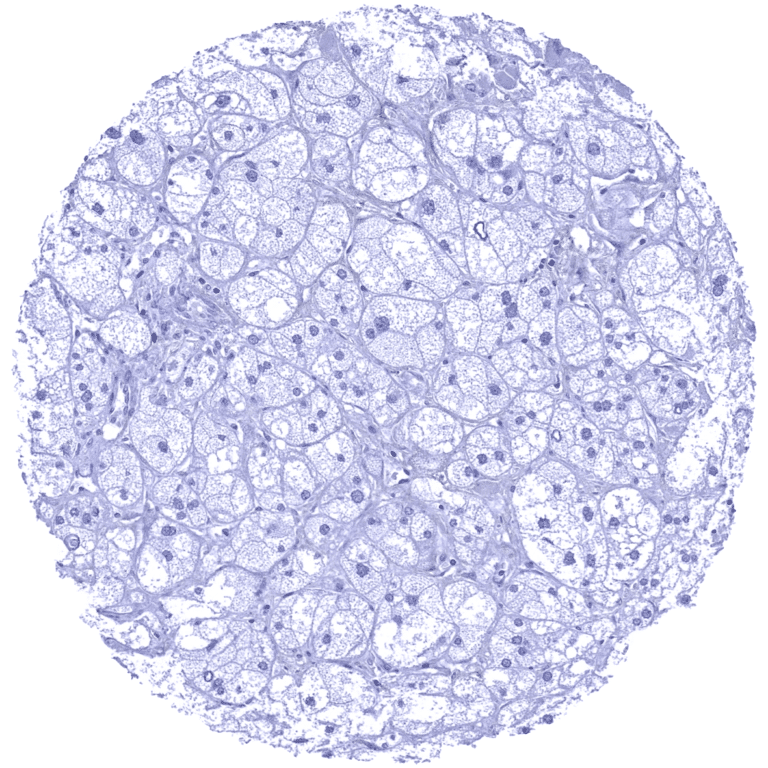 Cancer Tissue Gallery MUC1 / EMA - MS Validated Antibodies