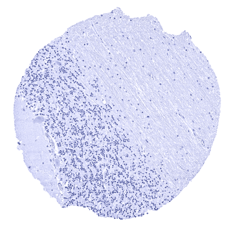 Normal Tissue Gallery Desmoglein 3 - MS Validated Antibodies