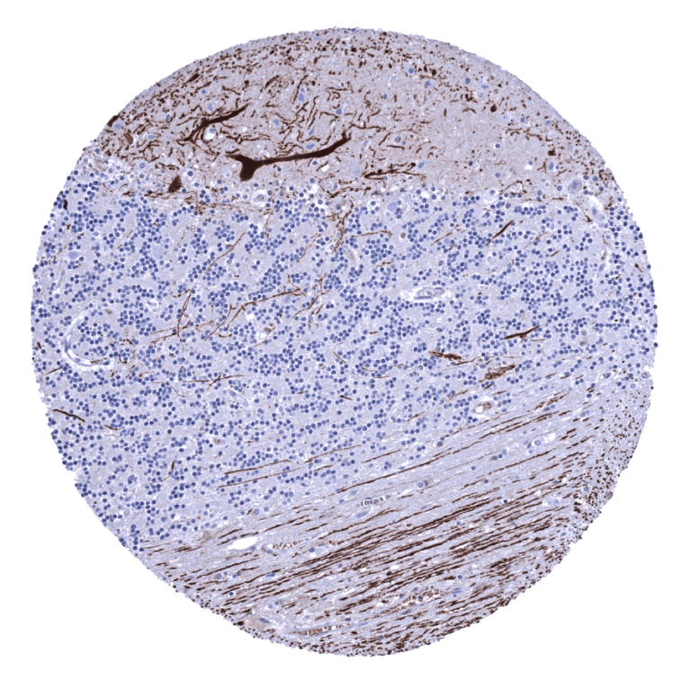 Normal Tissue Gallery Calbindin 1 - MS Validated Antibodies