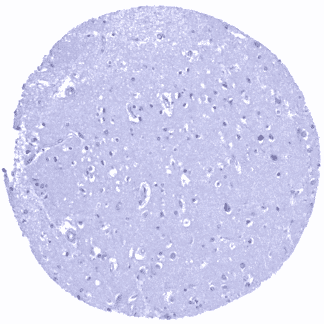 Normal Tissue Gallery Calbindin 1 - MS Validated Antibodies