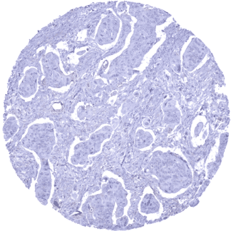 Cancer Tissue Gallery MUC1 / EMA - MS Validated Antibodies