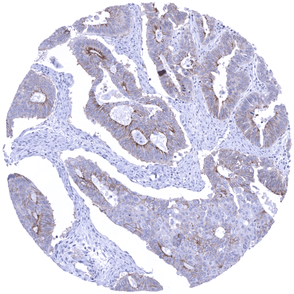 Cancer Tissue Gallery Desmoglein 3 - MS Validated Antibodies