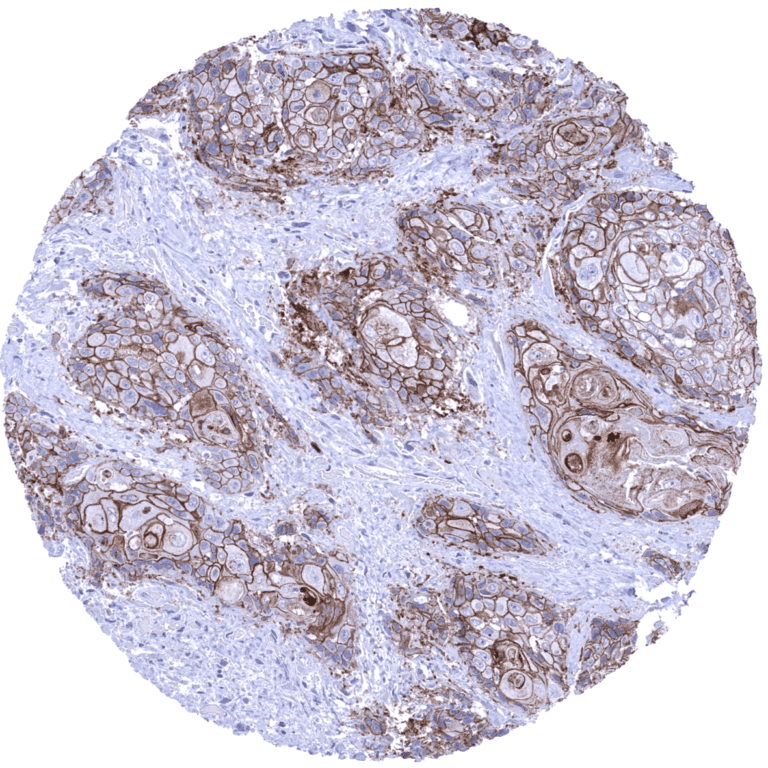 Desmoglein 3 (MSVA-543M) - MS Validated Antibodies