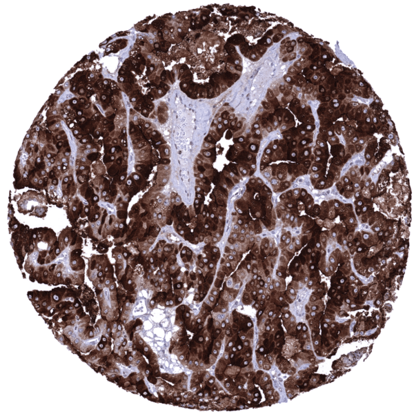 Cancer Tissue Gallery MUC1 / EMA - MS Validated Antibodies