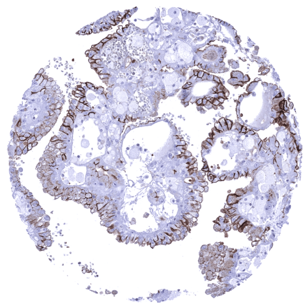 Cancer Tissue Gallery MUC1 / EMA - MS Validated Antibodies