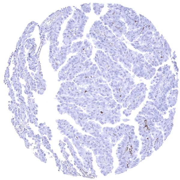 Cancer Tissue Gallery von Willebrand Factor / vWF - MS Validated Antibodies