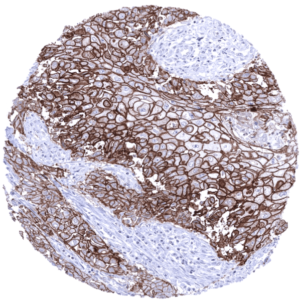 Desmoglein 3 (MSVA-543M) - MS Validated Antibodies