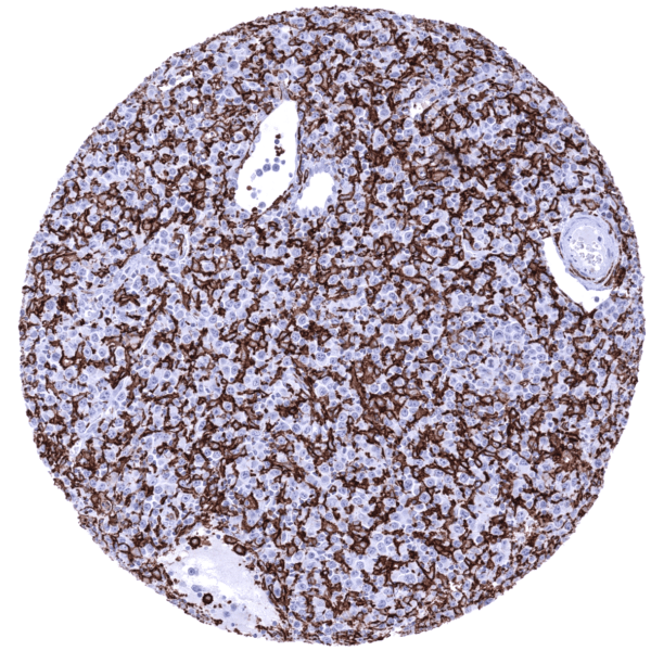 Cancer Tissue Gallery AIF 1 - MS Validated Antibodies