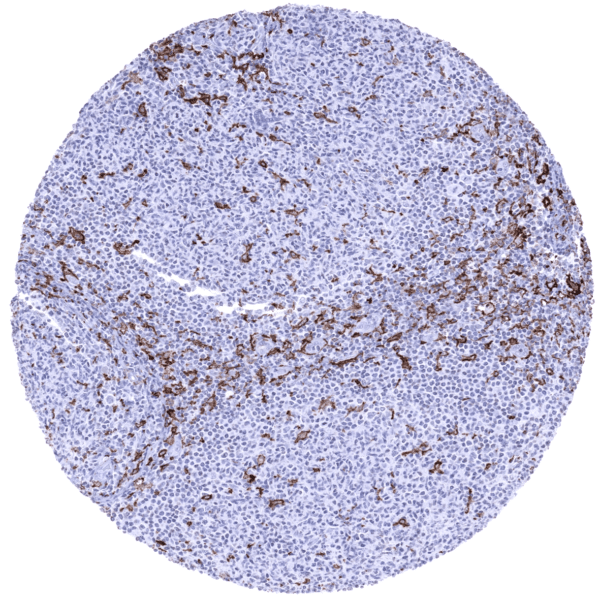 Cancer Tissue Gallery AIF 1 - MS Validated Antibodies
