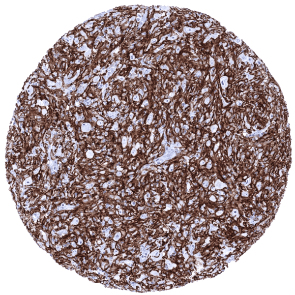 Cancer Tissue Gallery AIF 1 - MS Validated Antibodies