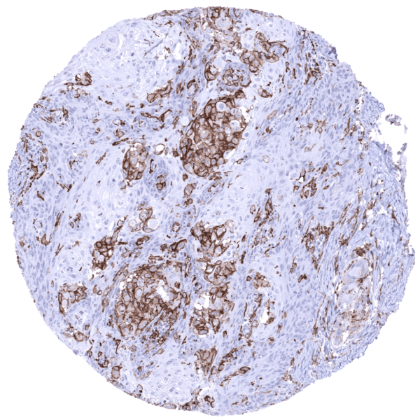 Cancer Tissue Gallery AIF 1 - MS Validated Antibodies