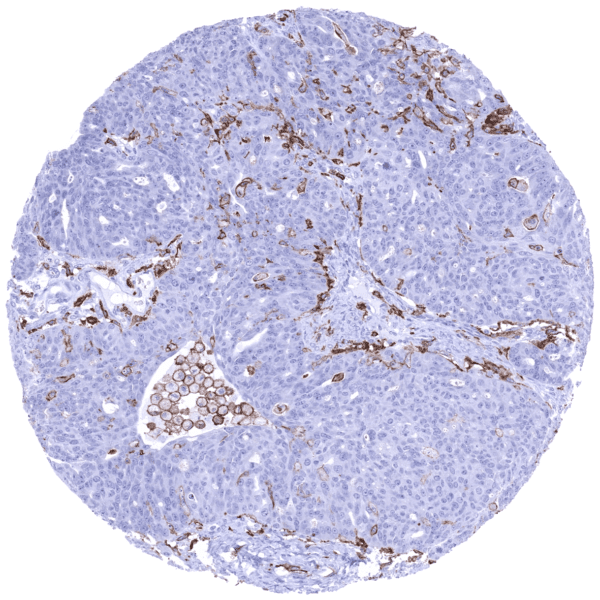 Cancer Tissue Gallery AIF 1 - MS Validated Antibodies