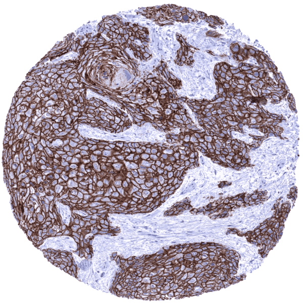 Desmoglein 3 (MSVA-543M) - MS Validated Antibodies