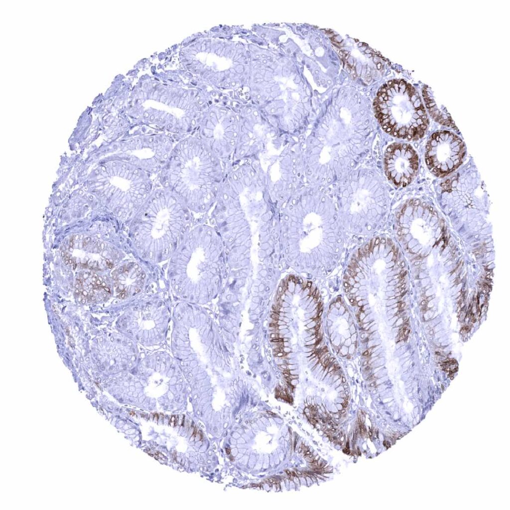 Uroplakin 1B (MSVA-734M) - MS Validated Antibodies