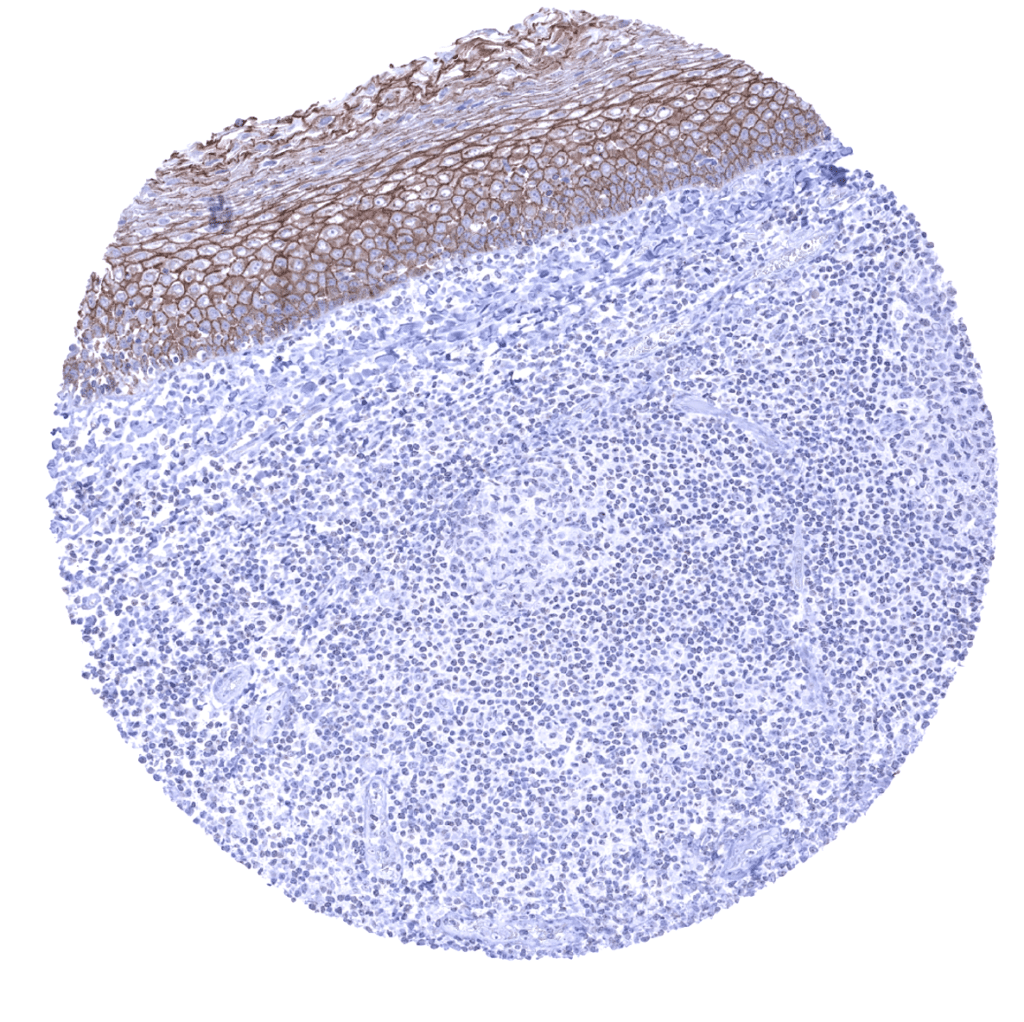 Desmoglein 3 (MSVA-543M) - MS Validated Antibodies