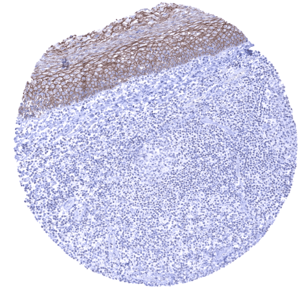 Desmoglein 3 (MSVA-543M) - MS Validated Antibodies