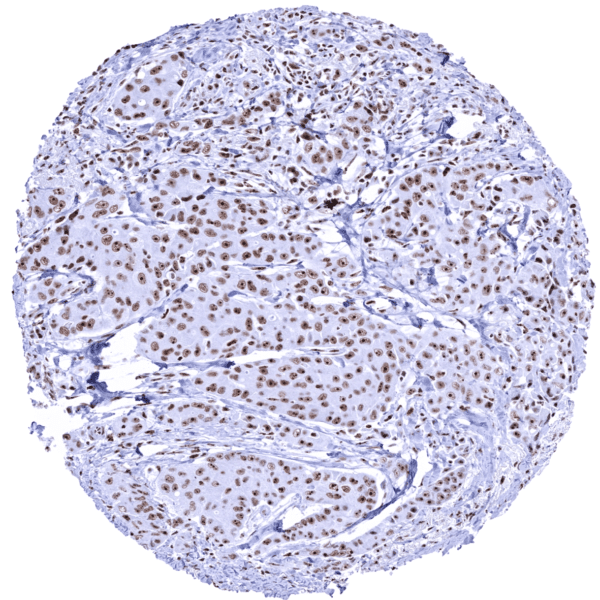 Cancer Tissue Gallery Nucleolin - MS Validated Antibodies