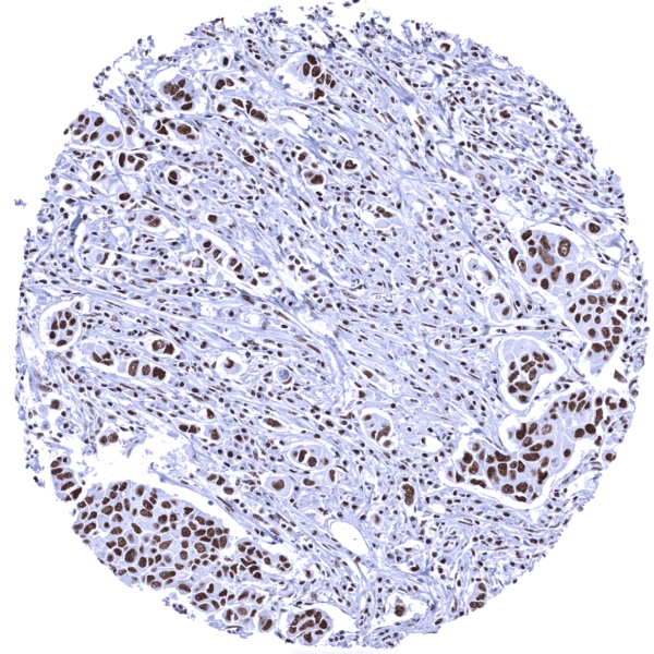 Cancer Tissue Gallery Nucleolin - MS Validated Antibodies