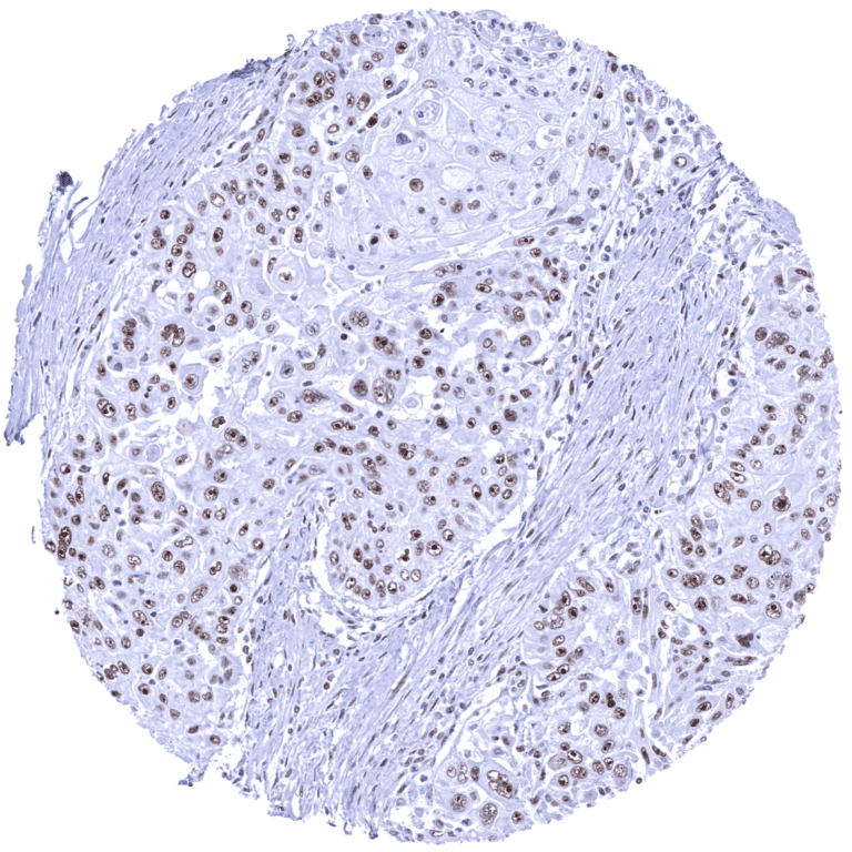 Cancer Tissue Gallery Nucleolin - MS Validated Antibodies