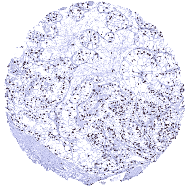 Cancer Tissue Gallery Nucleolin - MS Validated Antibodies